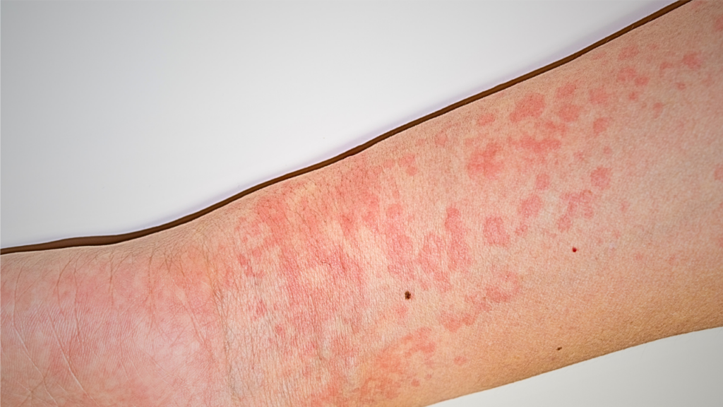 6 Most Common Causes Of Itchy Bumps On Skin - Femhealth Cares